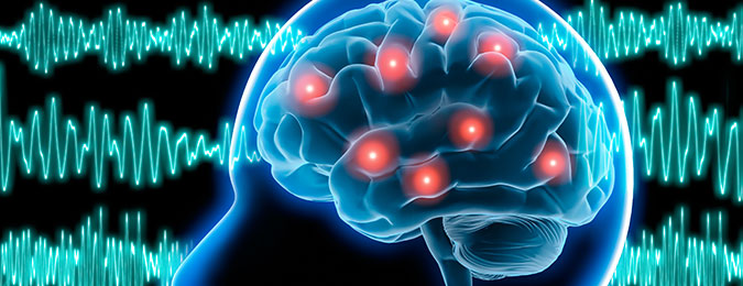 Elektroenzephalogramm (EEG) - neurobasel